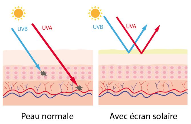 Soleil : attention à votre peau et aux grains de beauté ! - Bio Infos Santé